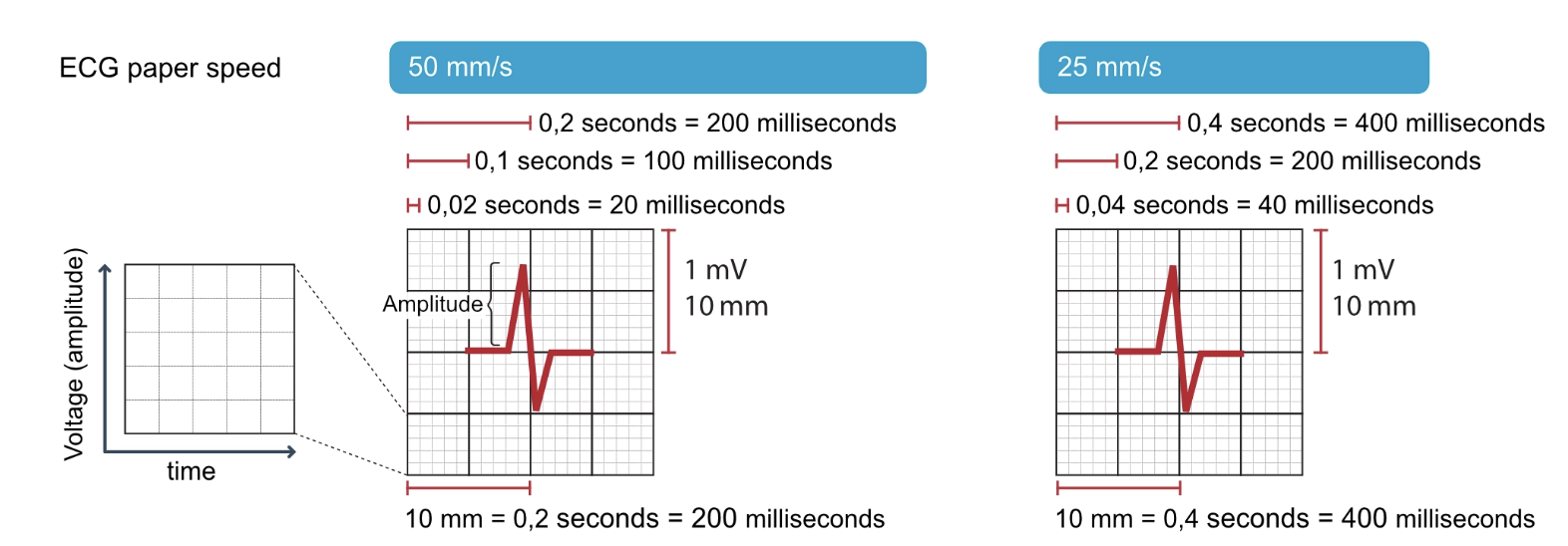 ECG Interpretation Made Simple – MOC Stepwise Approach