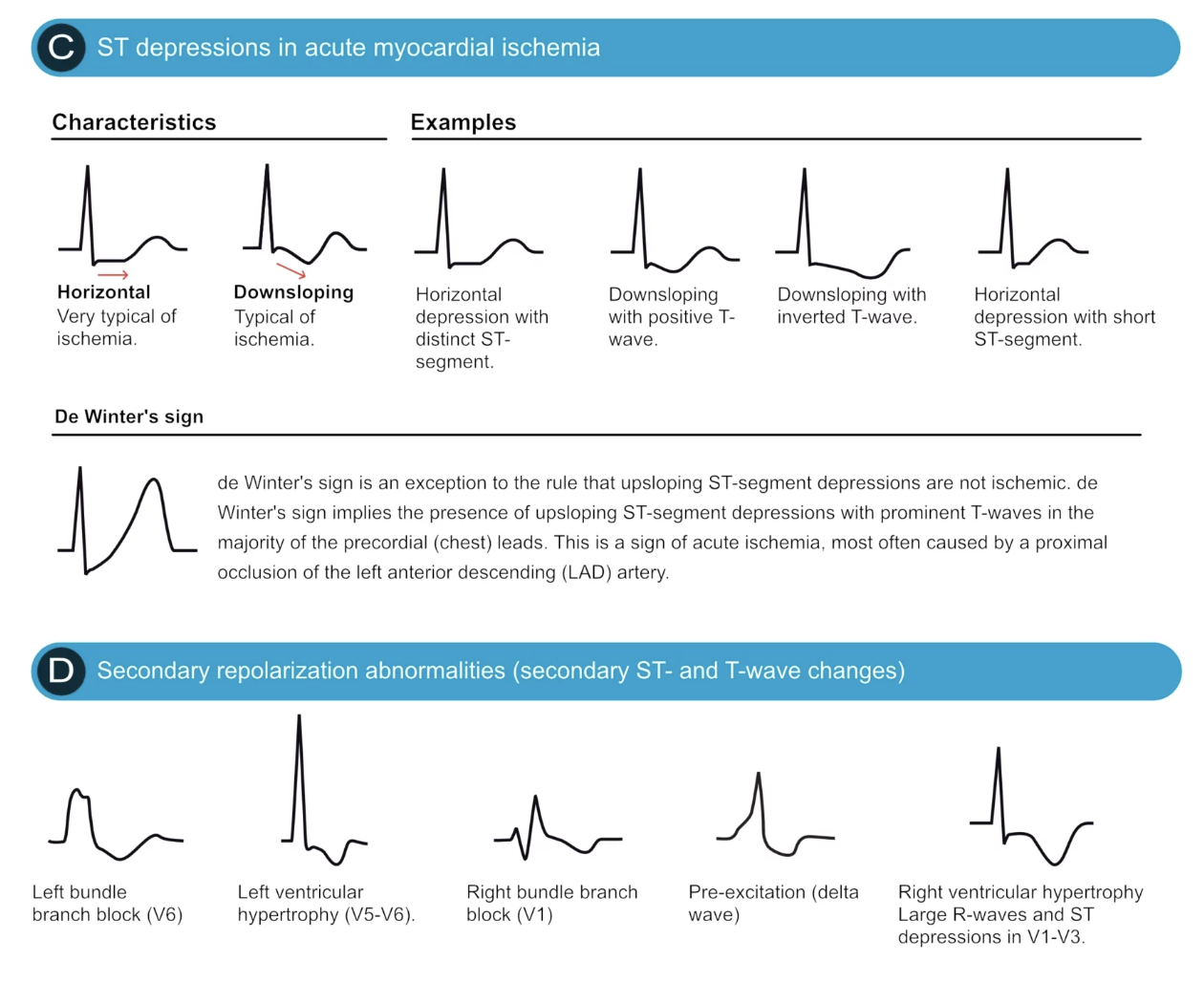 ECG Interpretation Made Simple – MOC Stepwise Approach
